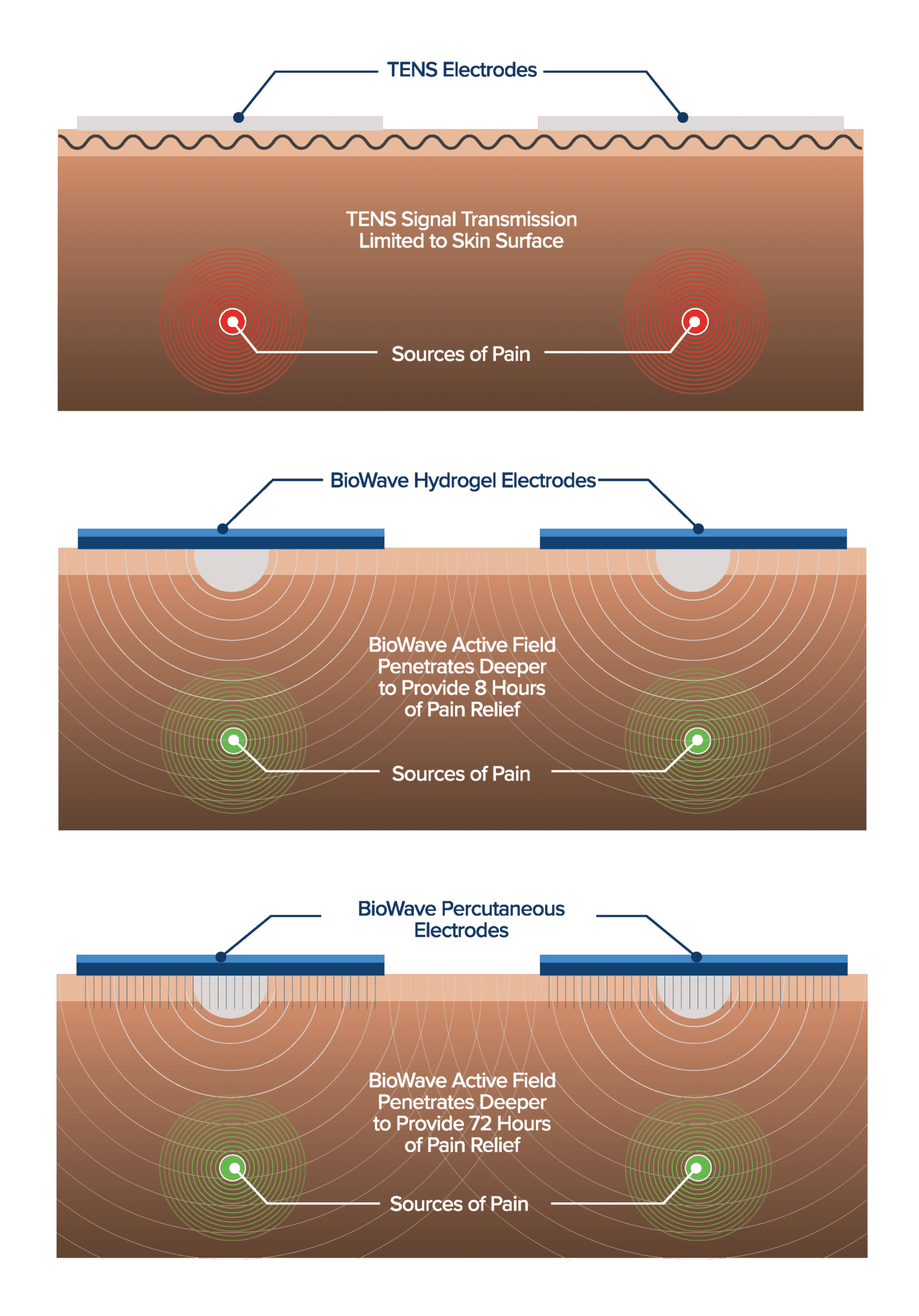 What Is BioWave? Drug-Free Pain Relief Explained